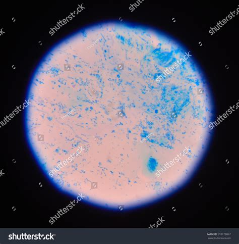 Blue Cells Gram Staining Called Grams Stock Photo Shutterstock