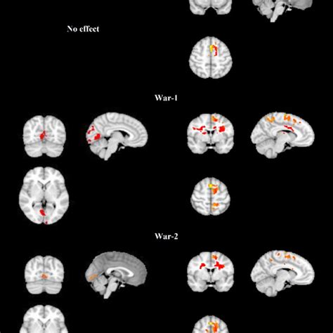 the fmri data analysis results download scientific diagram