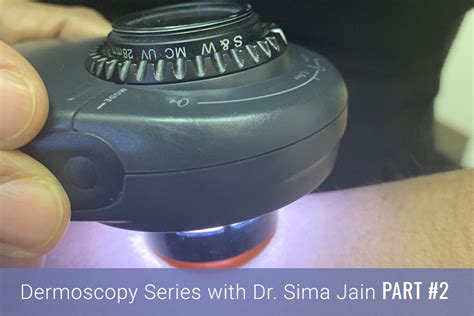 Practical Dermoscopy Part 2 Next Steps In Dermatology