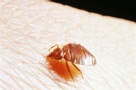 Punaises de lit Le ministère de la Santé active le système de