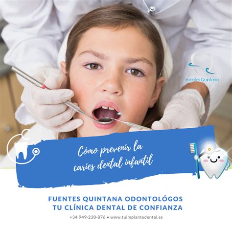 Cómo prevenir la caries dental infantil tuimplantedental es