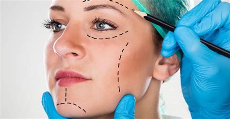 Quelles sont les stars qui ont fait de la chirurgie esthétique