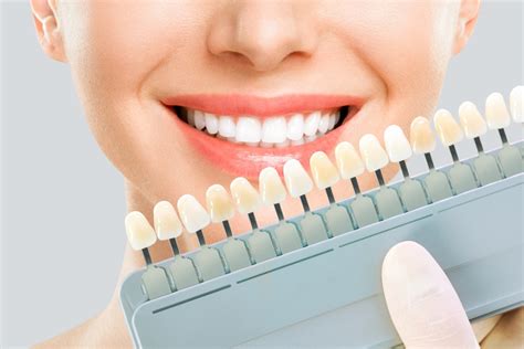 Full Set Of Dental Veneers In Turkey Price