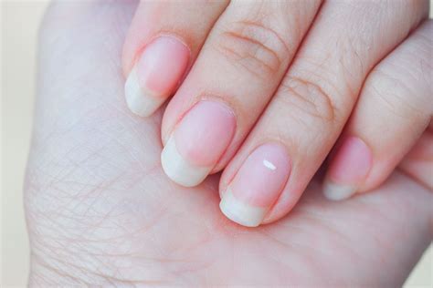 Por qué me salen manchas blancas en las uñas