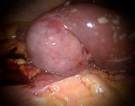Leber Mit Gallenblase 1 DocCheck