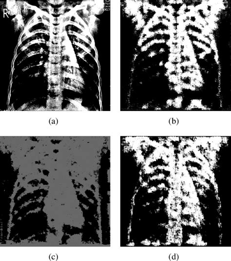 figure 12 from an adaptive dimension reduction algorithm for latent variables of variational