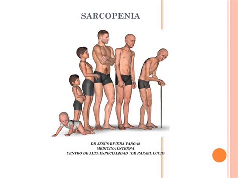 PDF SARCOPENIA uv mx y hasta un 3 a partir de los 60 años