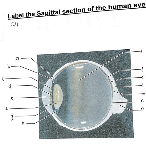 Sagittal Section Of Human Eye Diagram Quizlet
