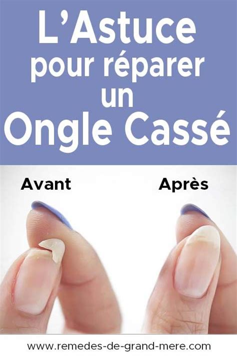 Ongle Cassé 5 Astuces Pour le Réparer Vite Fait Beauté et Hygiène
