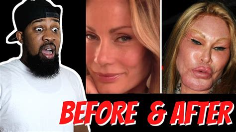 9 People Who Took Plastic Surgery Way Too Far YouTube