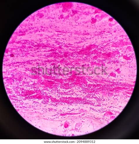 Gram Staining Called Grams Method Method Stock Photo