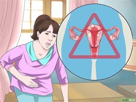 3 Formas De Tratar La Dismenorrea Primaria WikiHow