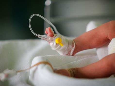 GEP ONCOLOGÍA PEDIÁTRICA