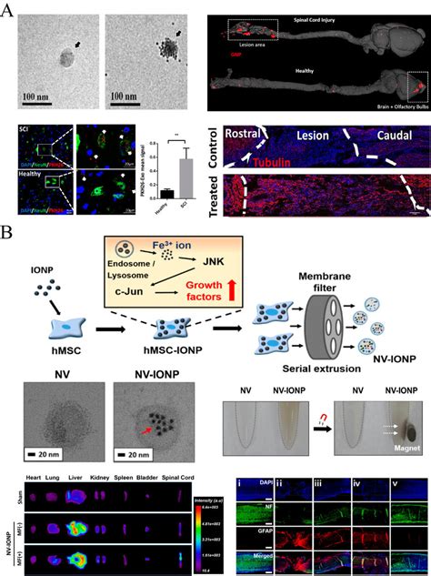 Schematic Illustration Of Exosome And Composite Nanovesicle Delivery