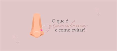 O que é granuloma e como evitar Betina Piercer