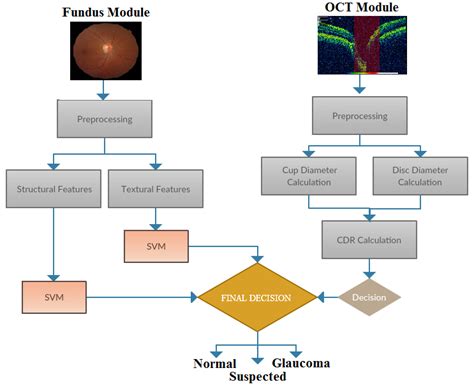 decision support system for detection of glaucoma using structural and non structural features