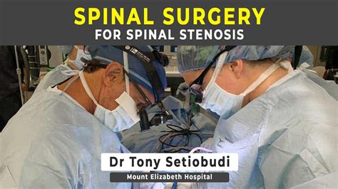 SURGERY FOR SPINAL STENOSIS YouTube