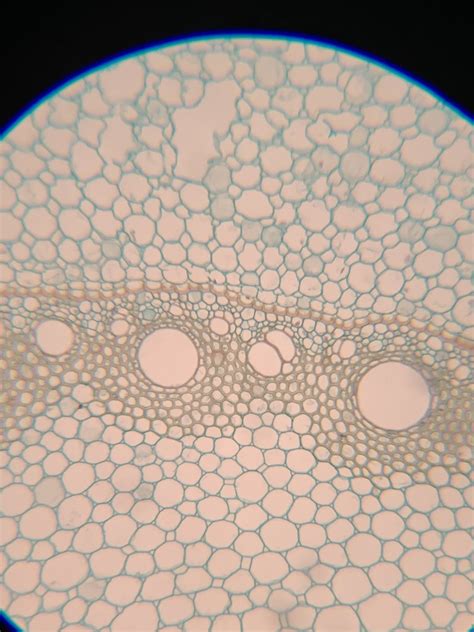 Monocot Root Diagram Quizlet