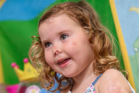 Five Year Old Quadruple Amputee Set To Take On Half Marathon After