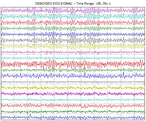 feature analysis of eeg signals using som