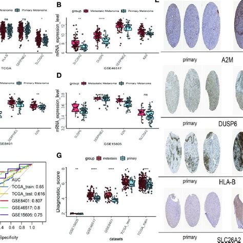 Construction And Validation Of The Diagnostic Model In Melanoma