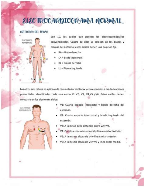 Bases Del Electrocardiograma Zoe Mandujano Potrero UDocz