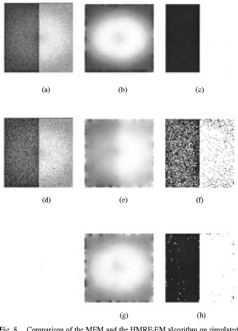 figure 8 from segmentation of brain mr images through a hidden markov random field model and the