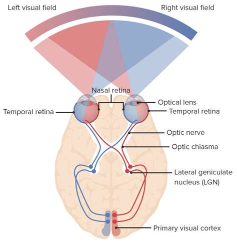 Visual Pathway Visual Field Defects Lecturio Medical