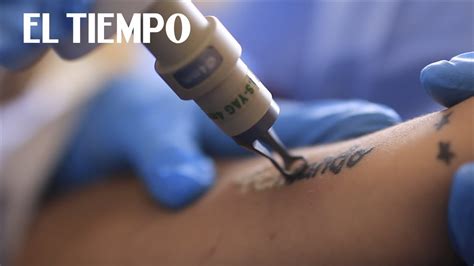 El arte en la piel se desvanece descubre cómo se transforma un tatuaje