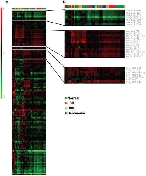 A Tree Generated By Unsupervised Hierarchical Clustering Pearson