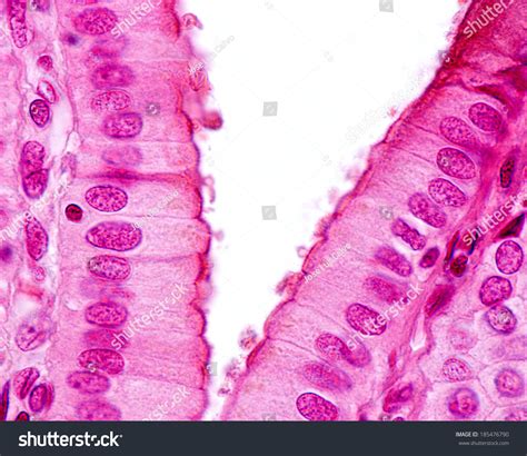 Simple Columnar Epithelium Gallbladder