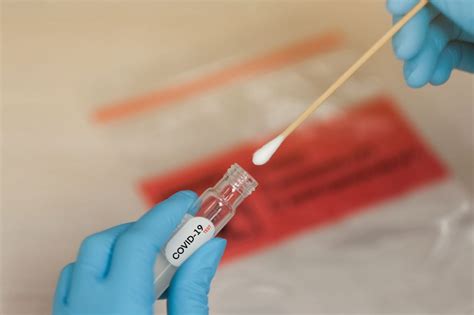 LNS Only Carrying Out COVID 19 Tests For Hospitals LNS