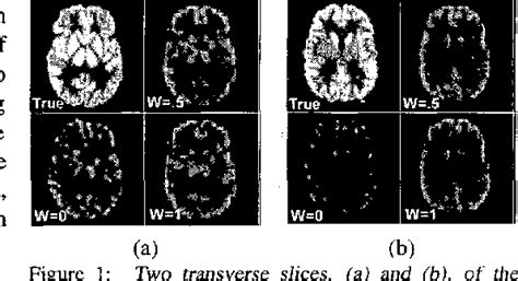 figure 1 from a bayesian multiscale framework for spect semantic scholar
