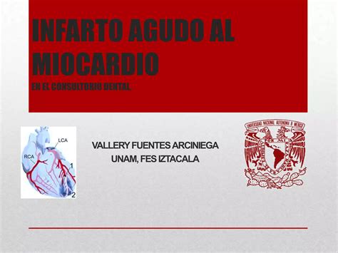 Infarto Agudo Al Miocardio PPT