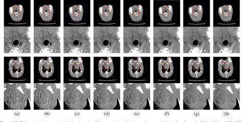figure 4 from low dose ct image denoising using multi level feature fusion network and edge
