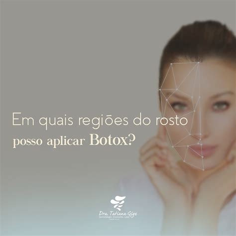 Em quais regiões do rosto posso aplicar botox