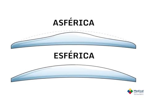 Lentes esféricas vs asféricas cuáles son mejores
