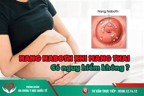Mổ polyp tử cung bao lâu mới có thai