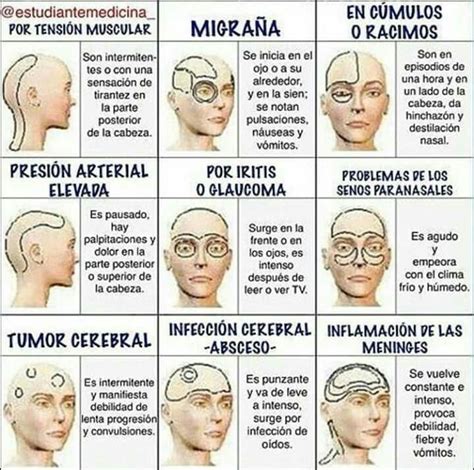 Pin De Rosario Salazar Murillo En Tipos De Dolor De Cabeza Tipos De