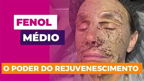 Peeling De Fenol O Poder Do Rejuvenescimento YouTube