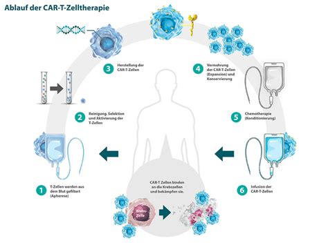 Ablauf Der CAR T Zelltherapie DocCheck