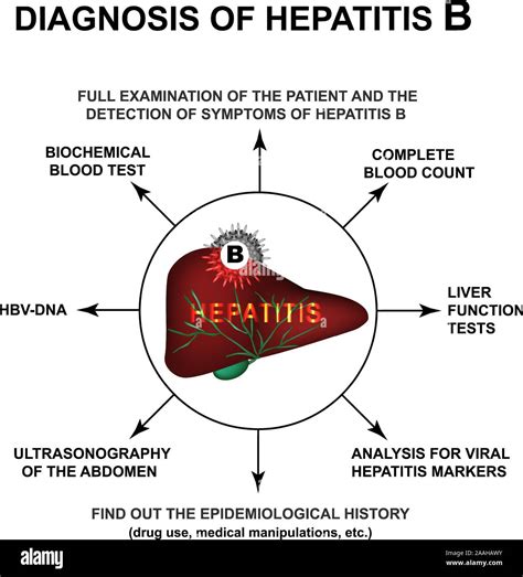 Diagnóstico de la hepatitis B La hepatitis Día Mundial La infografía