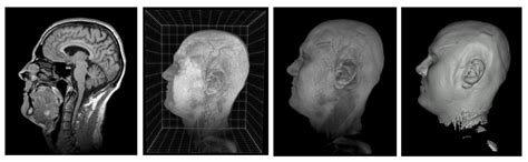 Volume Rendering Image Analysis Training Resources