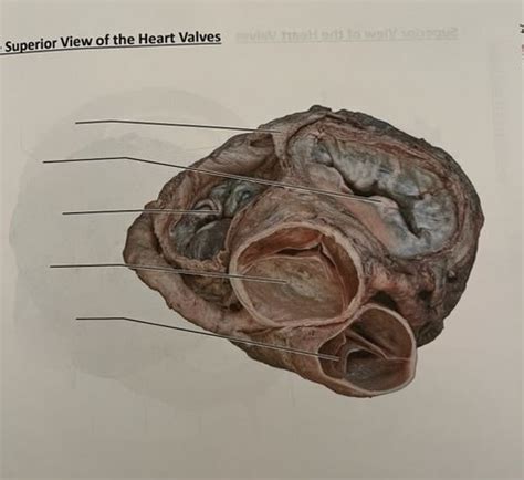 Superior View Of Heart Valves Diagram Quizlet