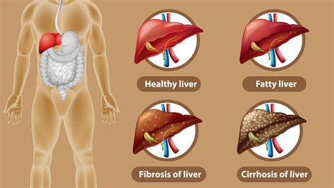 Liver Treatment Specialist In Chennai Dr Srivatsan Gurumurthy
