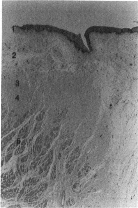 Hematoxylin And Eosin Stained Coronal Section Of Vocal Fold Showing