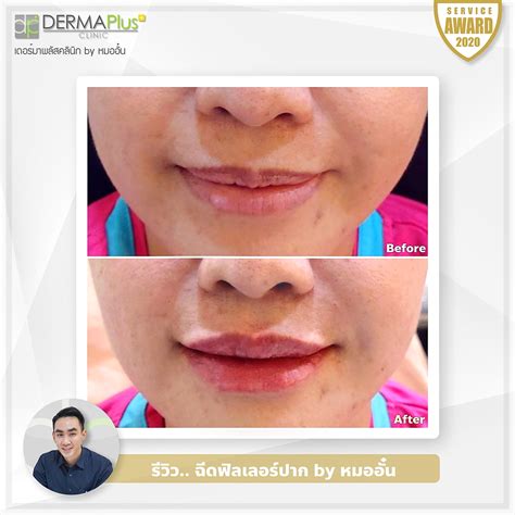 Lips Dermaplus Clinic Phuket By