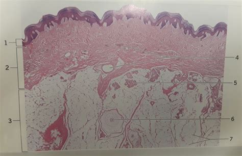 Thick Skin Diagram Quizlet