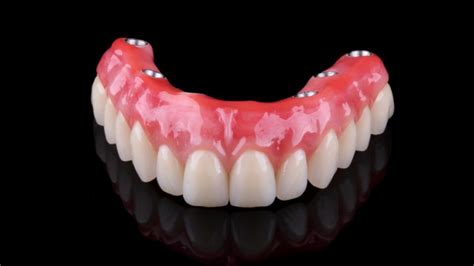 3 motivos para você trocar a dentadura por uma prótese protocolo