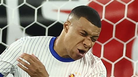 Kylian Mbappé se fractura la nariz así fue el momento del accidente